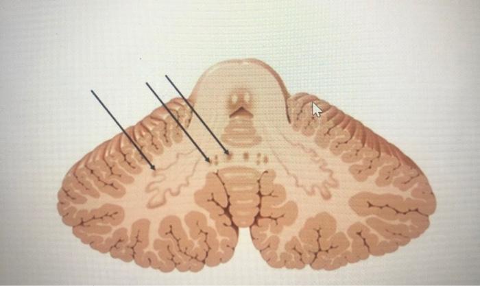 Solved Identify highlighted area or area marked by black | Chegg.com