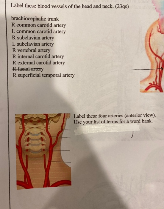 Solved Label these blood vessels of the head and neck. (234) | Chegg.com