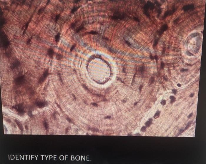 Solved IDENTIFY TYPE OF BONE. IDENTIFY POINTED STRUCTURE. | Chegg.com Solved IDENTIFY TYPE OF BONE. IDENTIFY POINTED STRUCTURE. | Chegg.com