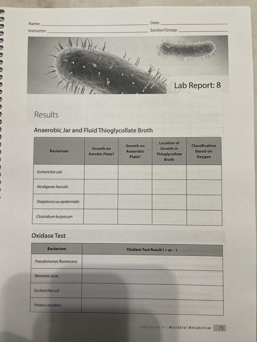 Solved Phenol Red Broth Glucose Sucrose Lactose Bacterium | Chegg.com