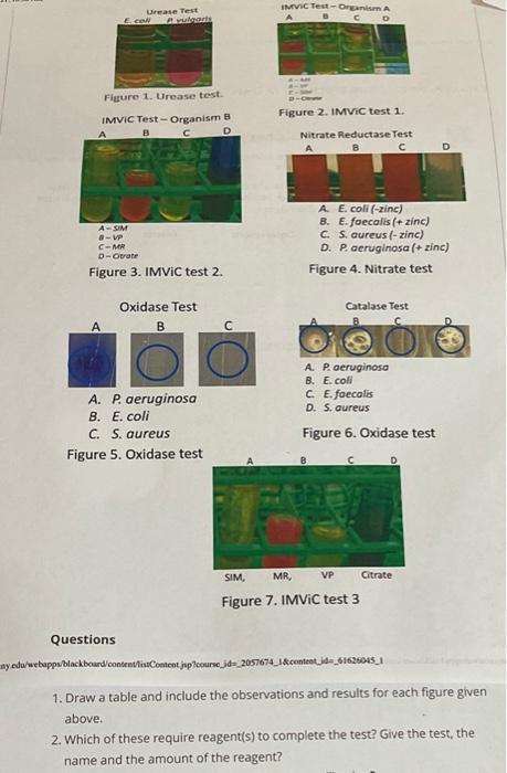 Solved IMVIC Test-Organi A Urease Test E. Figure 1. Urease | Chegg.com