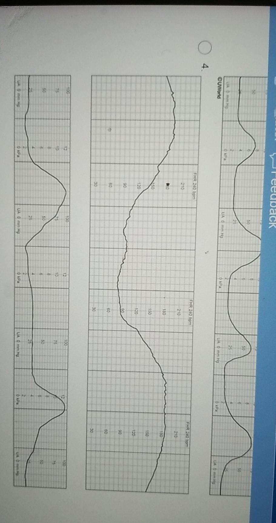 Solved A nurse is caring for a client at 37 weeks gestation | Chegg.com
