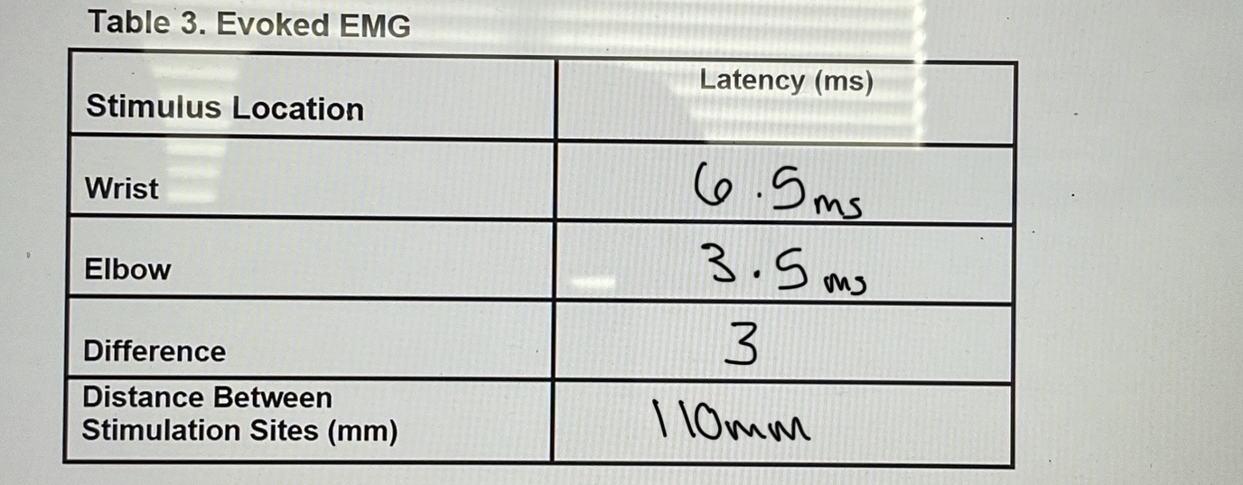 Solved Using the conduction velocity equation given below, | Chegg.com