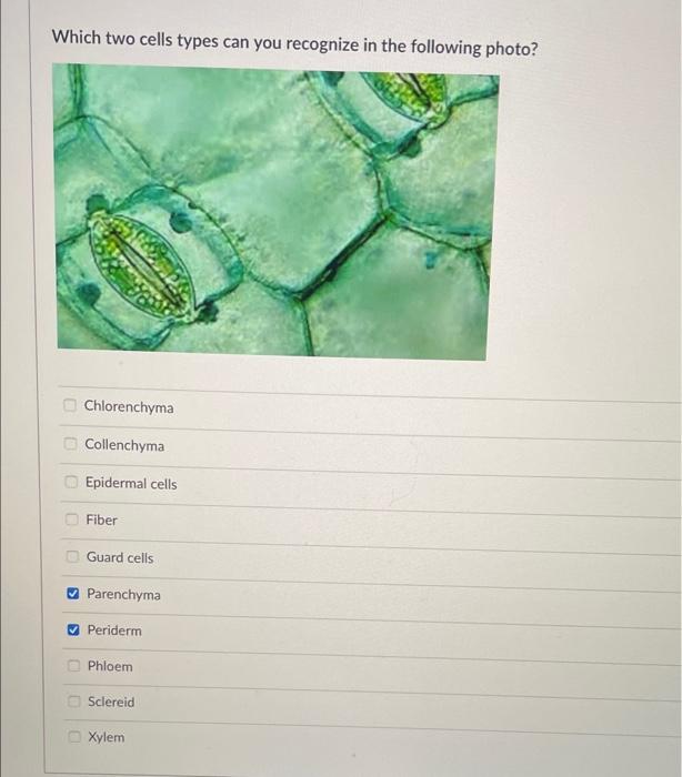 Solved Which two cells types can you recognize in the | Chegg.com
