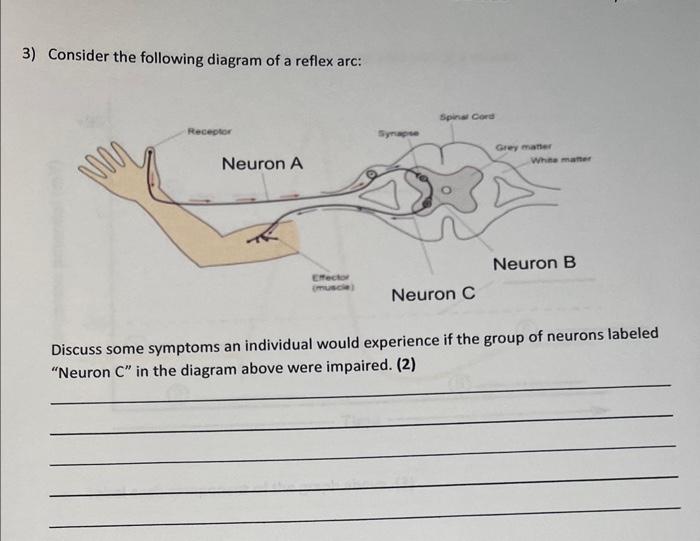 Solved 3) Consider the following diagram of a reflex arc: | Chegg.com