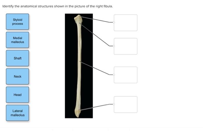 Solved Label the structures of either the tibia or fibula. | Chegg.com Solved Label the structures of either the tibia or fibula. | Chegg.com