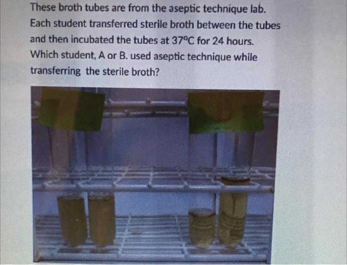 Solved These broth tubes are from the aseptic technique lab. | Chegg.com