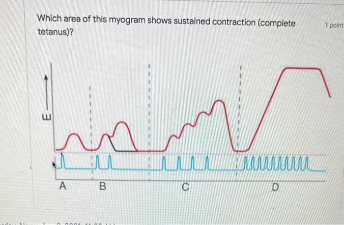 Solved Which area of this myogram shows sustained | Chegg.com