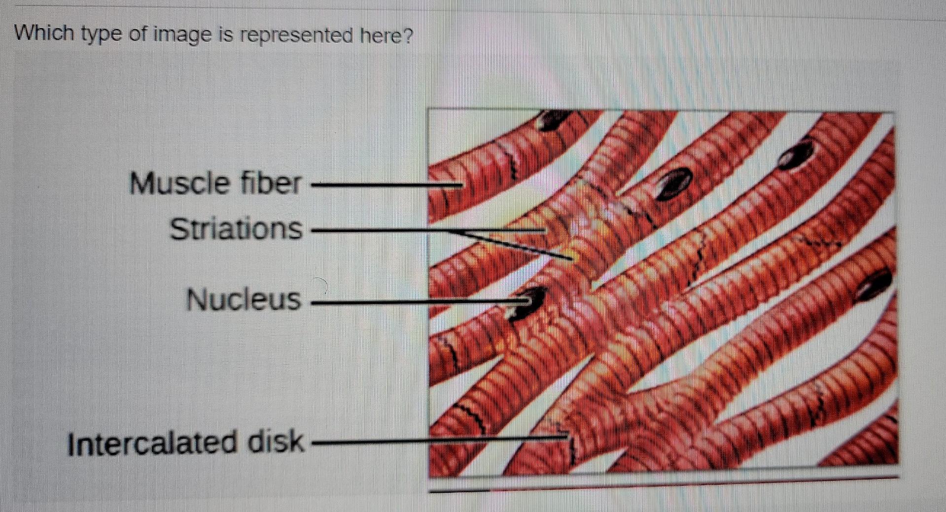 Solved Which type of image is represented here? Muscle fiber | Chegg.com