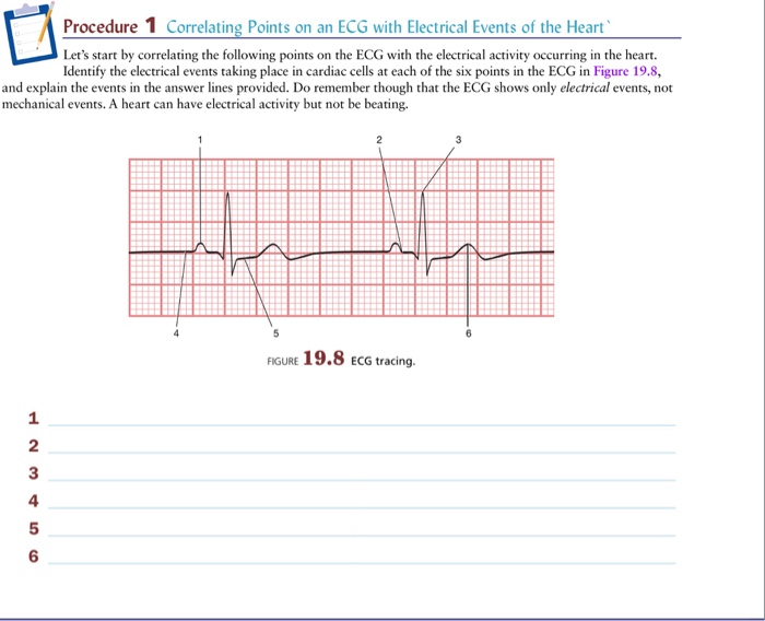 Solved Procedure 1 Correlating Points On An Ecg With
