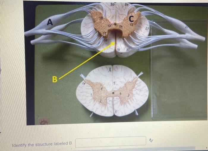 Solved 20 A C 2 B Identify the structure labeled B | Chegg.com