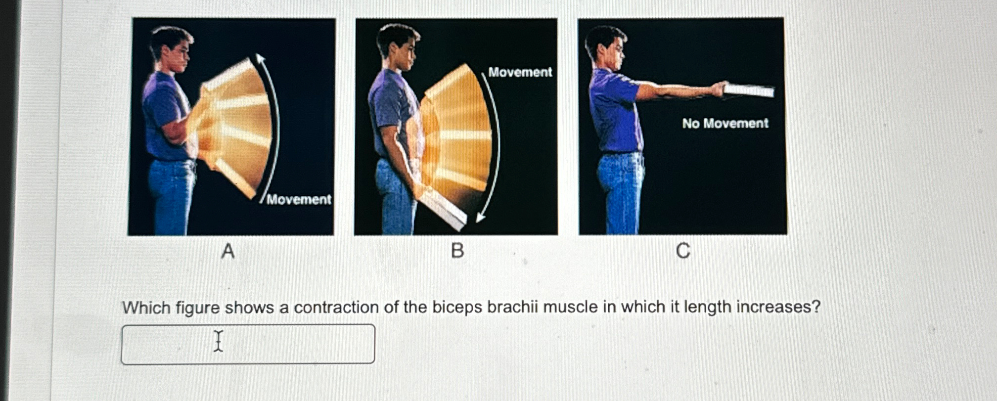Solved A BCWhich figure shows a contraction of the biceps | Chegg.com