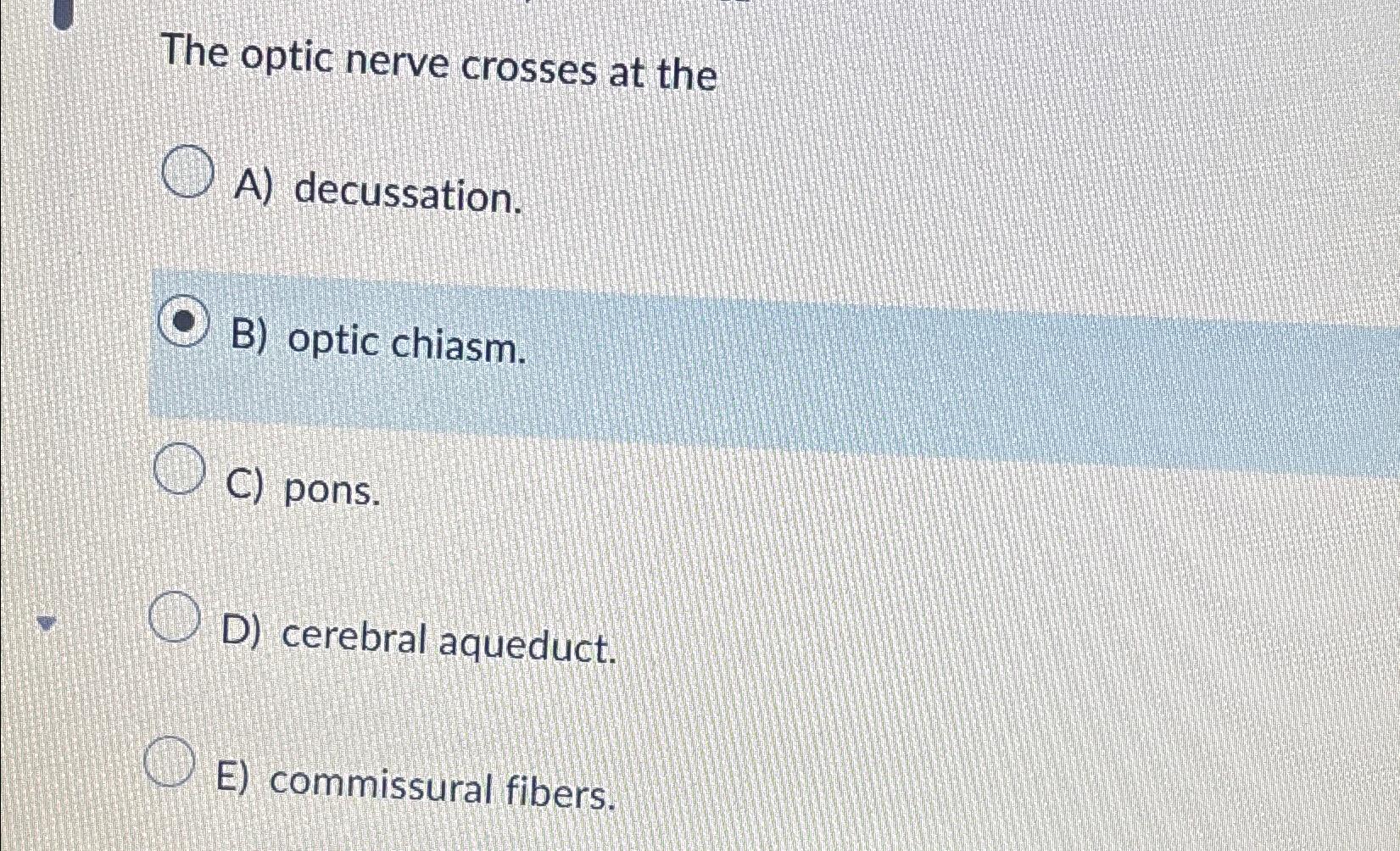 Solved The optic nerve crosses at theA) ﻿decussation.B) | Chegg.com