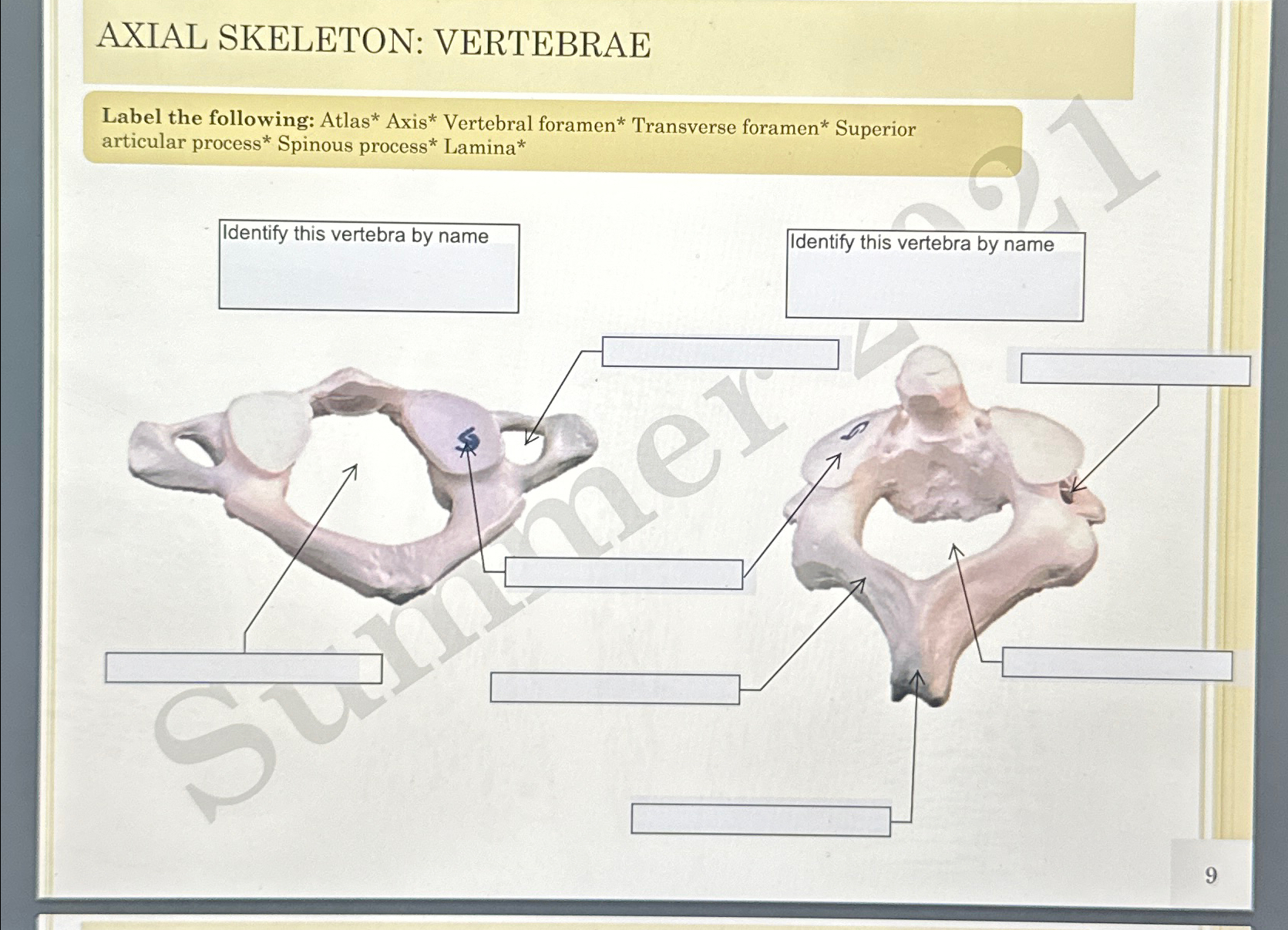 Solved AXIAL SKELETON: VERTEBRAELabel the following: Atlas* | Chegg.com