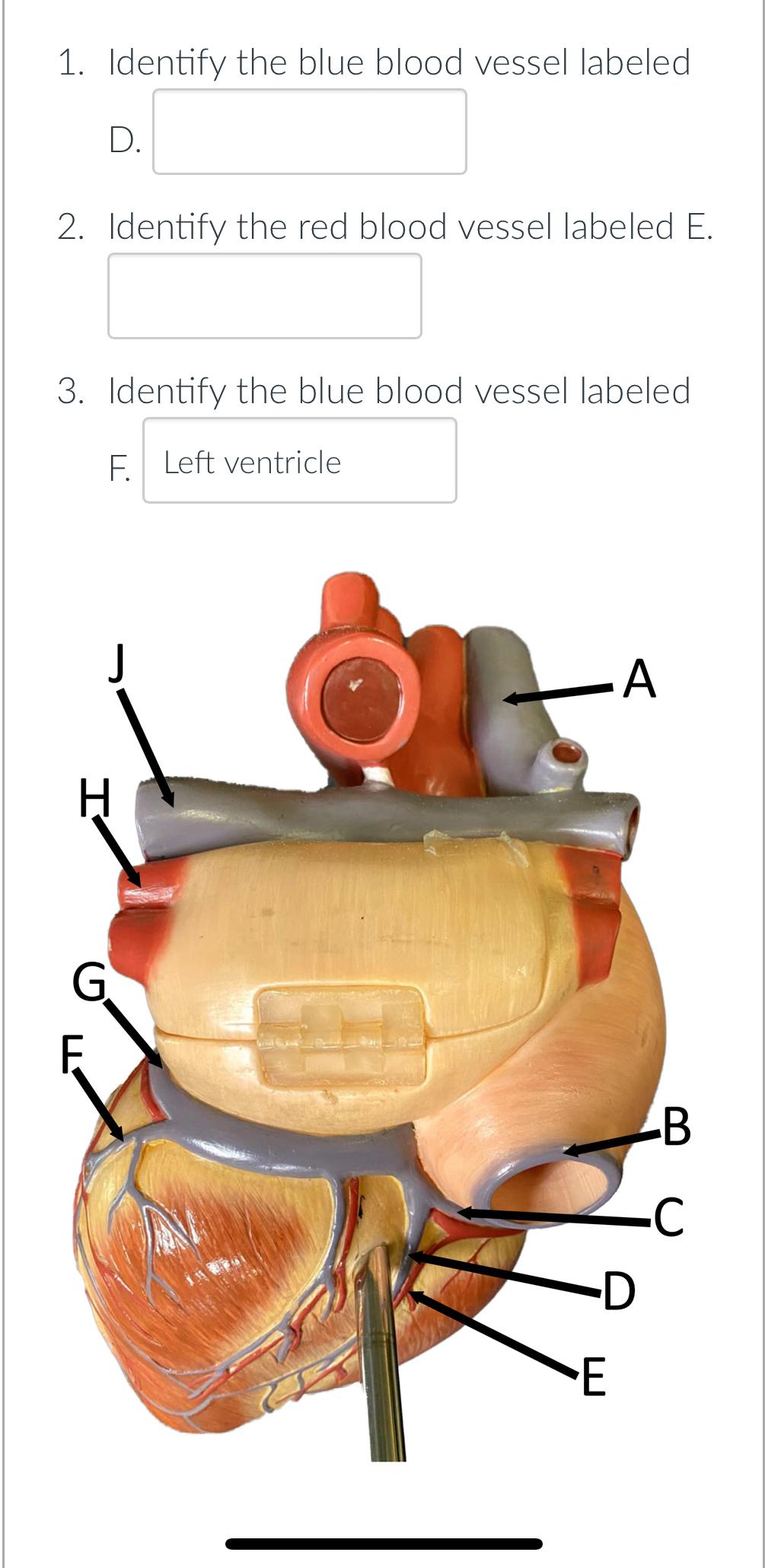 Solved Identify the blue blood vessel labeledD.Identify the | Chegg.com
