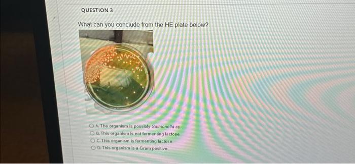 Solved What can you conclude from the HE plate below? A. The | Chegg.com