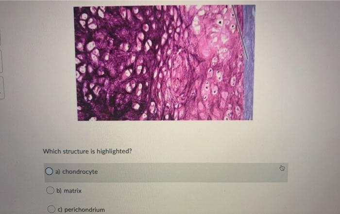 Solved Which structure is highlighted? a) chondrocyte b) | Chegg.com