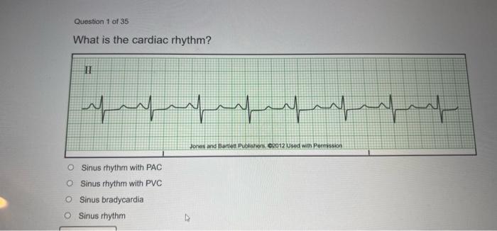 Solved Question 1 of 35 What is the cardiac rhythm? Sinus | Chegg.com