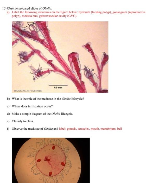 Solved 4) Observe a prepared slide of Scypha with | Chegg.com