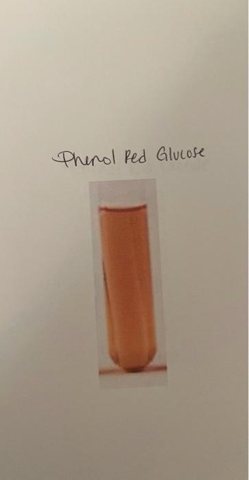 Solved The phenol red broth control Compare to the control | Chegg.com