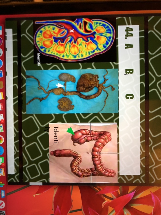 Solved 46. A B C XX Iden Identify this covering Identify | Chegg.com