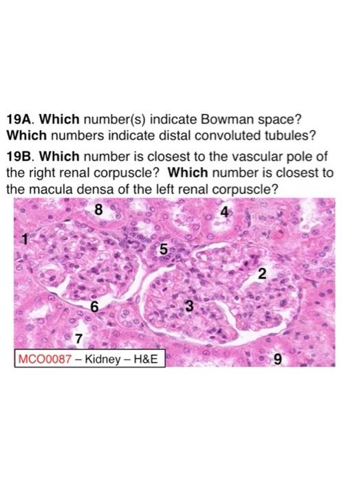 Solved 19A. Which number(s) indicate Bowman space? Which | Chegg.com