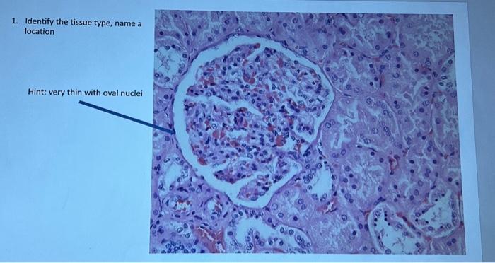 Solved 1. Identify the tissue type, name a location 2. | Chegg.com Solved 1. Identify the tissue type, name a location 2. | Chegg.com