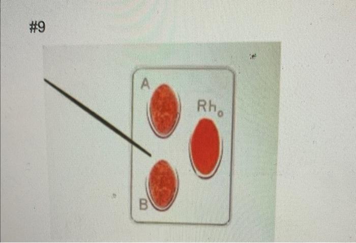 Solved #9 A Rh B | Chegg.com