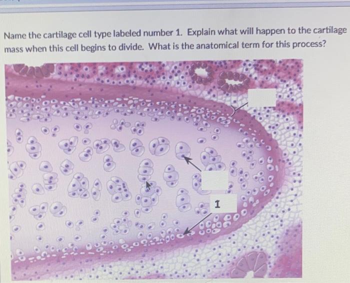 Solved name the cartilage cell type labeled number one. | Chegg.com