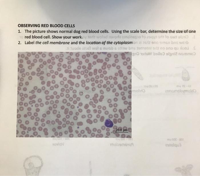 Solved OBSERVING RED BLOOD CELLS 1. The picture shows normal | Chegg.com