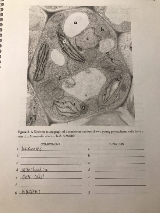 Solved Figure 2-1. Electron micrograph of a transverse | Chegg.com