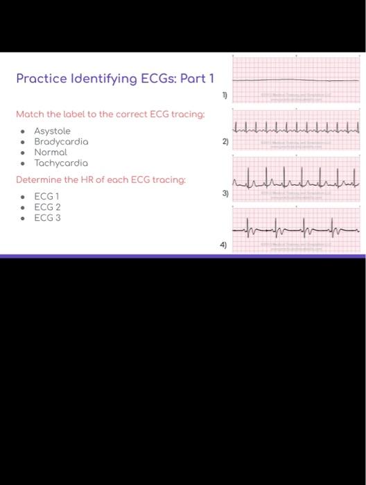 Practice Identifying ECGs: Part 1 Motch the lobel to | Chegg.com