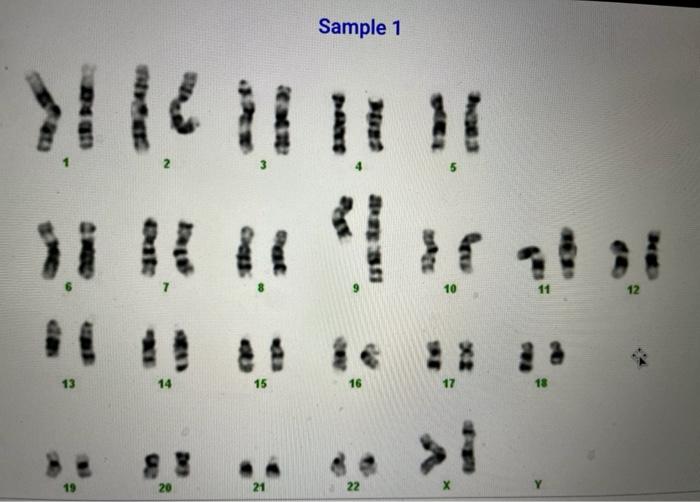 Solved Compare translocations in patients with lymphoma by | Chegg.com