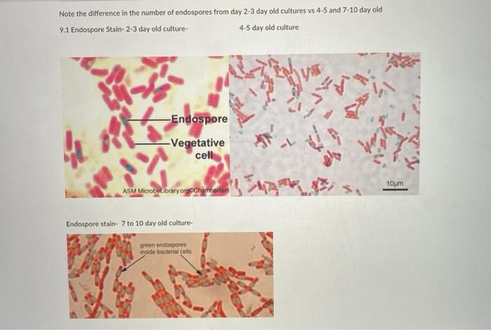 Solved Note the difference in the number of endospores from | Chegg.com
