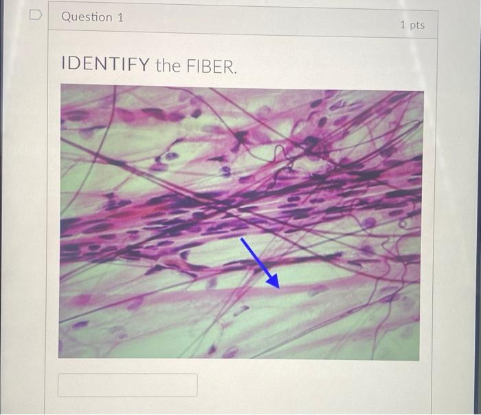 Solved IDENTIFY the FIBER. IDENTIFY the STRUCTURE/FEATURE | Chegg.com Solved IDENTIFY the FIBER. IDENTIFY the STRUCTURE/FEATURE | Chegg.com