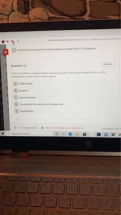 Solved tatoard.com 1622 Nucleus thoracicus posterior Clarke | Chegg.com