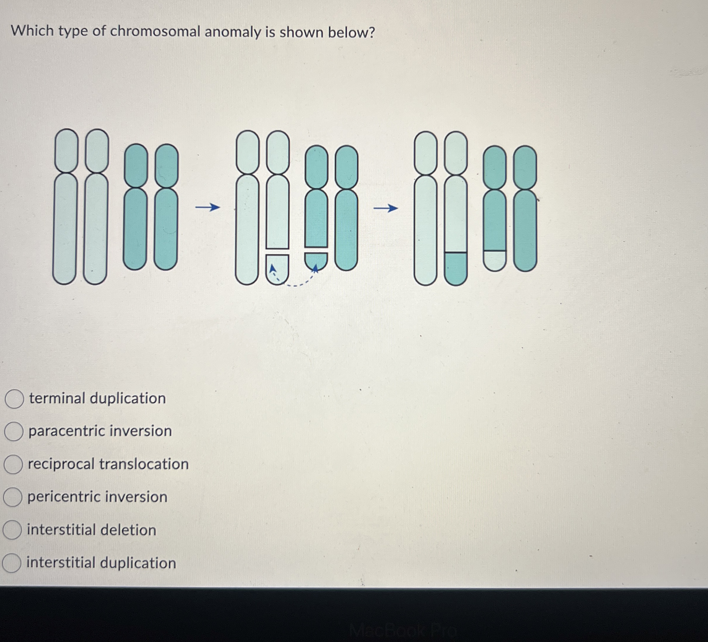 Solved Which type of chromosomal anomaly is shown below? | Chegg.com