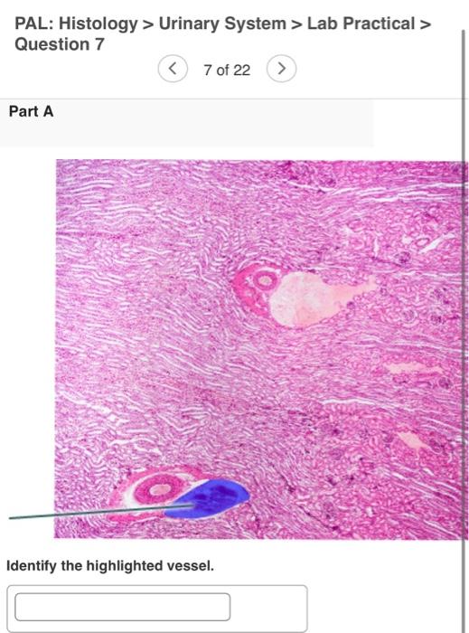 Solved PAL: Histology > Urinary System > Lab Practical > | Chegg.com