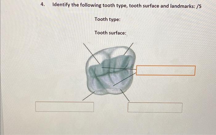 Solved 1. Identify the following tooth type, tooth surface | Chegg.com