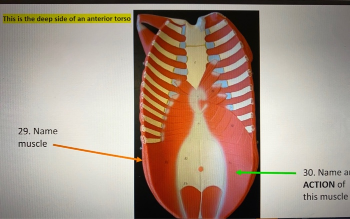 Solved This is the deep side of an anterior torso 29. Name | Chegg.com