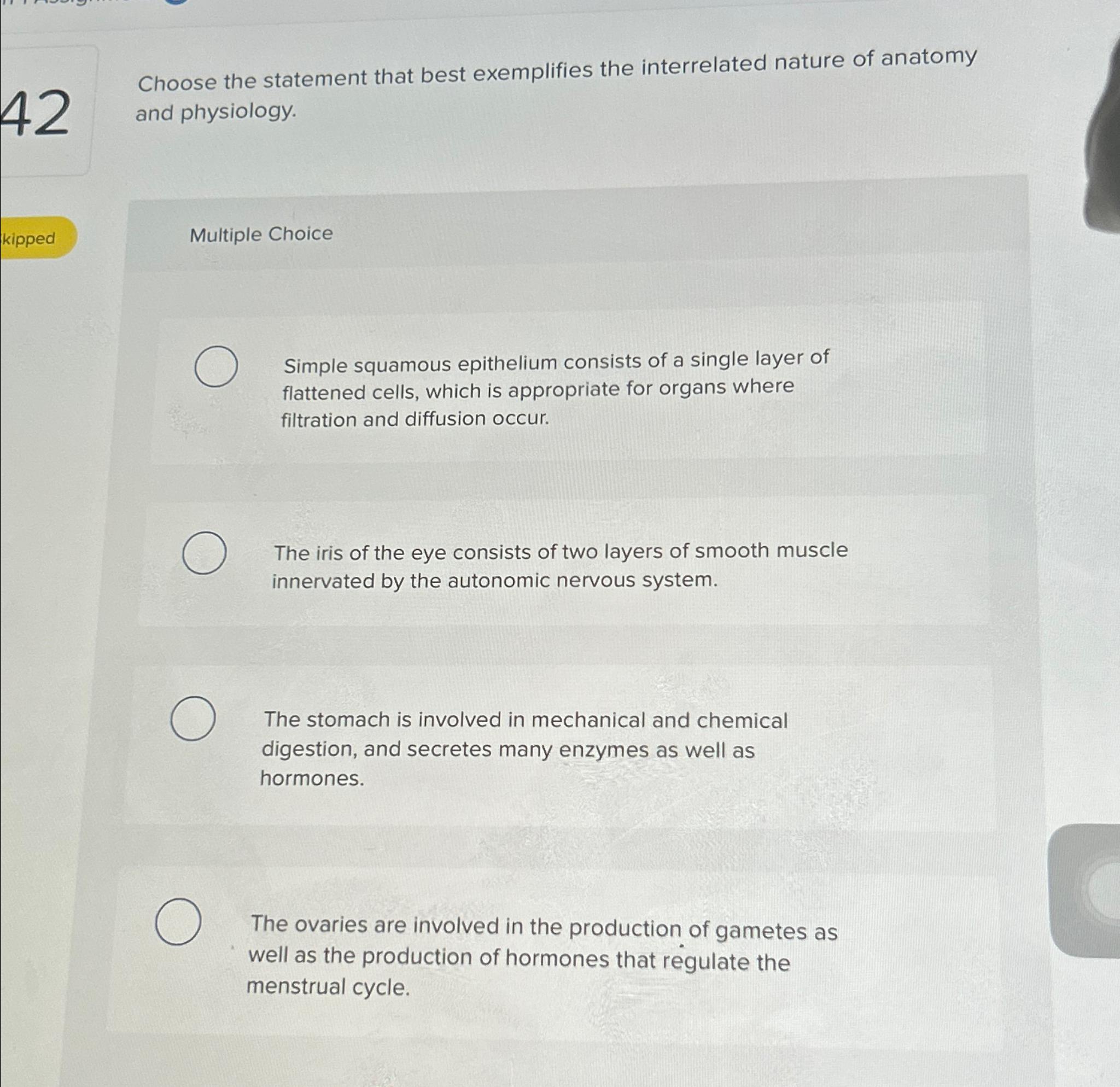 Solved Choose the statement that best exemplifies the | Chegg.com