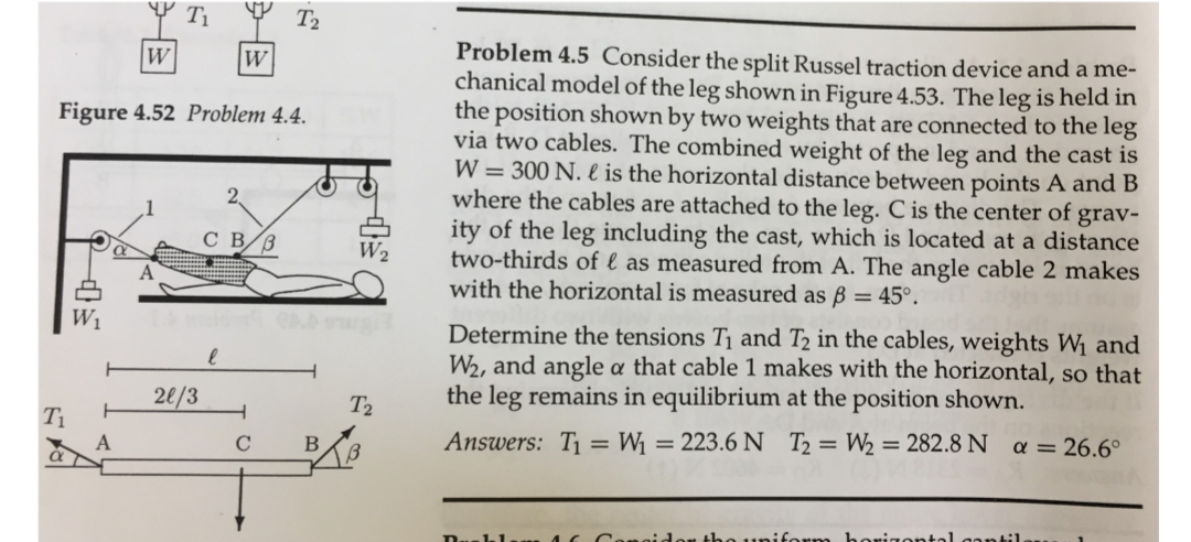 Solved Problem 4.5 Consider the split Russel traction device | Chegg.com