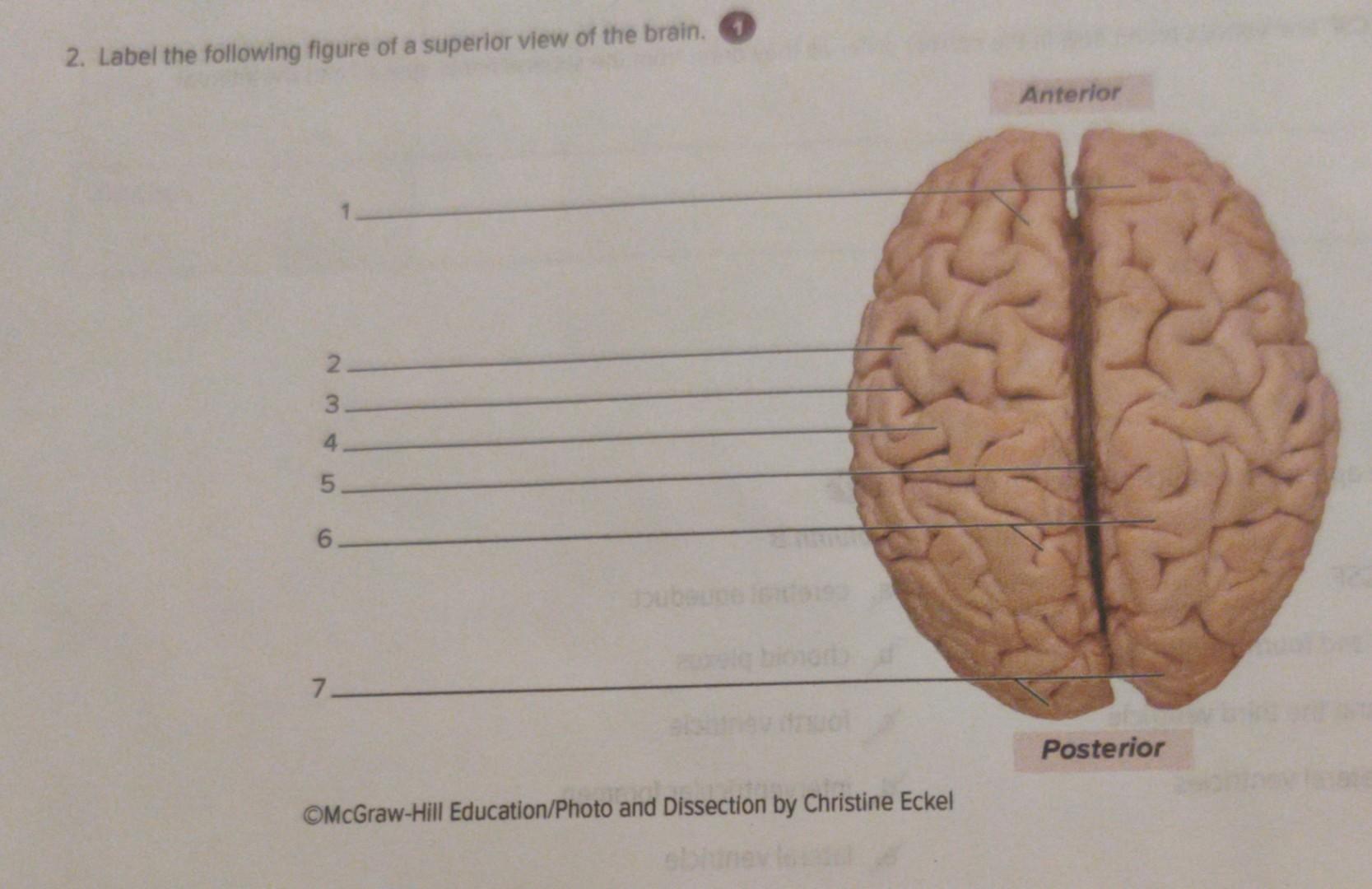 Solved 2. Label the following figure of a superior view of | Chegg.com