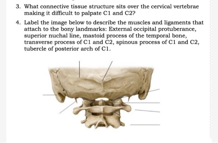 Solved 3. What connective tissue structure sits over the | Chegg.com