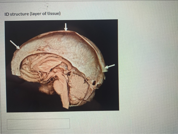 Solved ID structure (layer of tissue) ID structure | Chegg.com