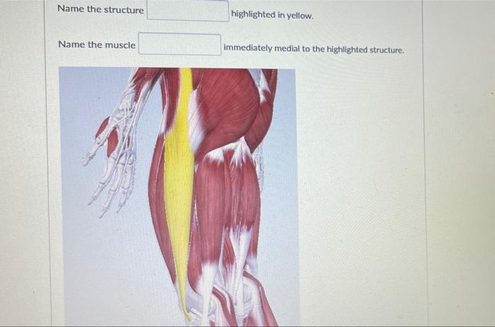 Solved Name the muscle highlighted in orange. Provide one | Chegg.com