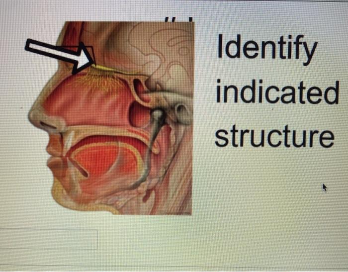 Solved Identify indicated structure | Chegg.com