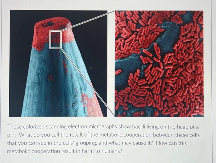 Solved These colorized scanning electron micrographs show | Chegg.com