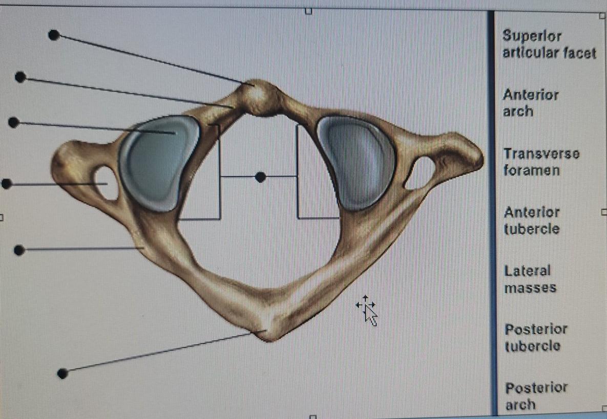 Solved Superior articular facet Anterior arch Transverse | Chegg.com