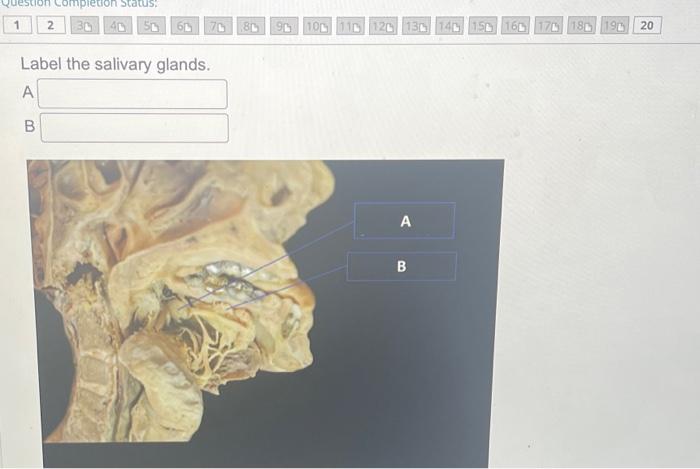 Solved Label the salivary glands. | Chegg.com